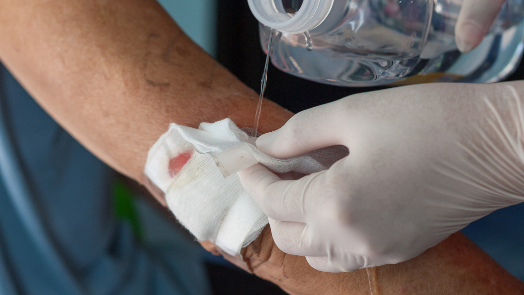 Correct Use Of Hydrogen Peroxide On Wounds Practical Guide PVS SPA